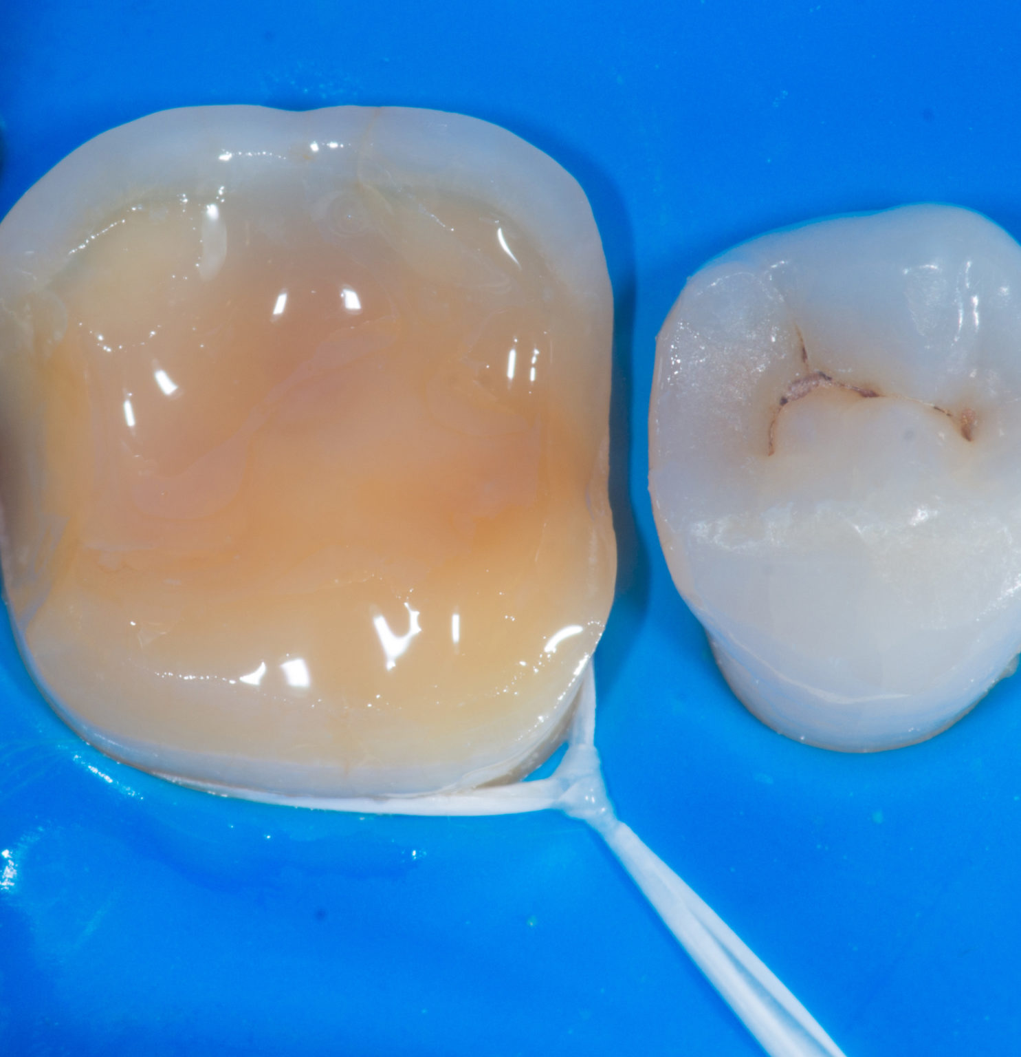 What is Biomimetic Dentistry? | Nejad Institute | Dr. Matt Nejad