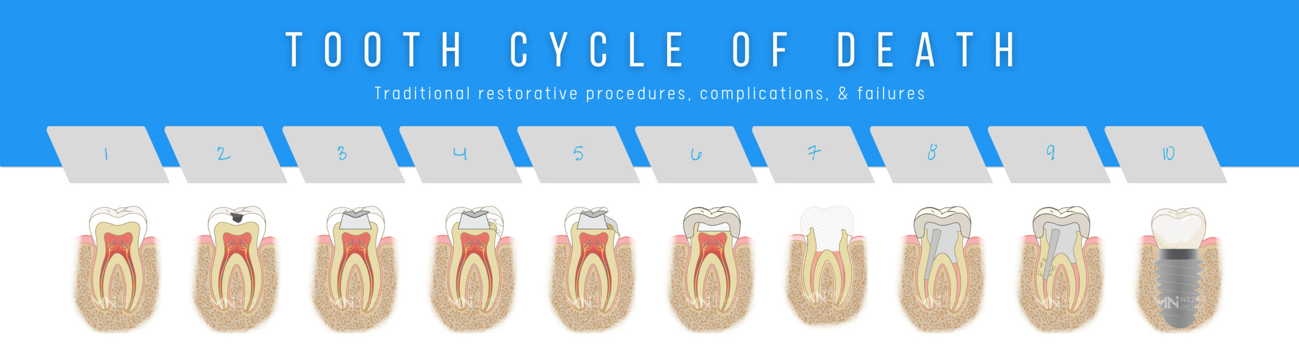 The Tooth Cycle of Death - Nejad Institute for Biomimetic Dentistry