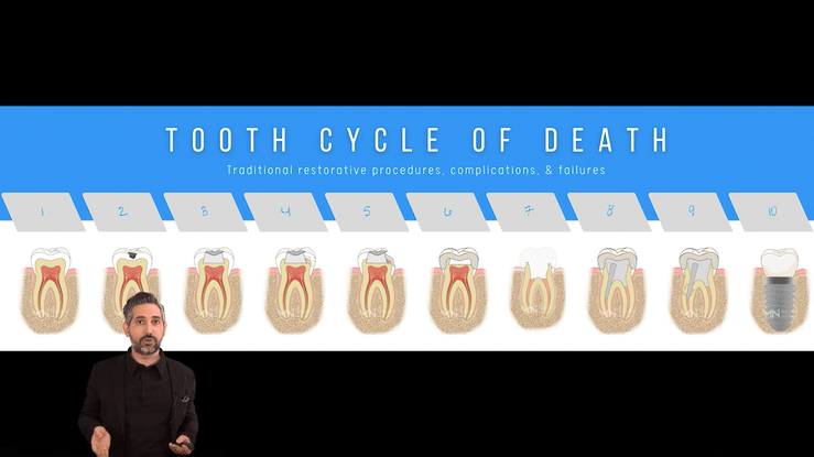 Saving Teeth for Life - Nejad Institute for Biomimetic Dentistry